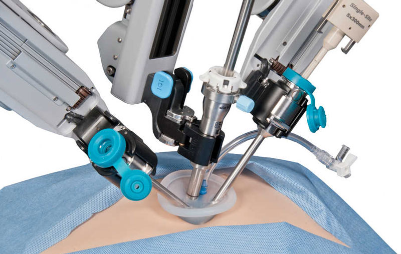 As Intuitive Surgical continues to shine, competitors are entering the ...